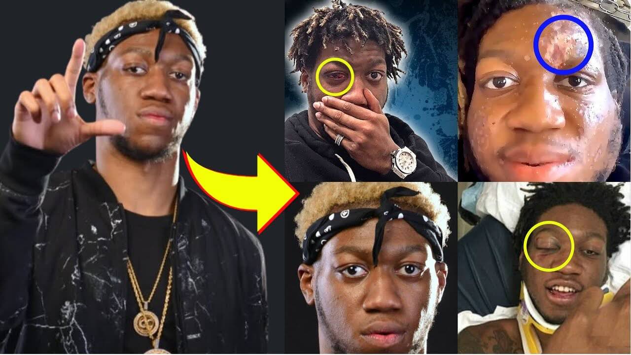 OG Maco Net Worth and Funeral: OG Dead at 32, Suffering Self-Inflicted ...